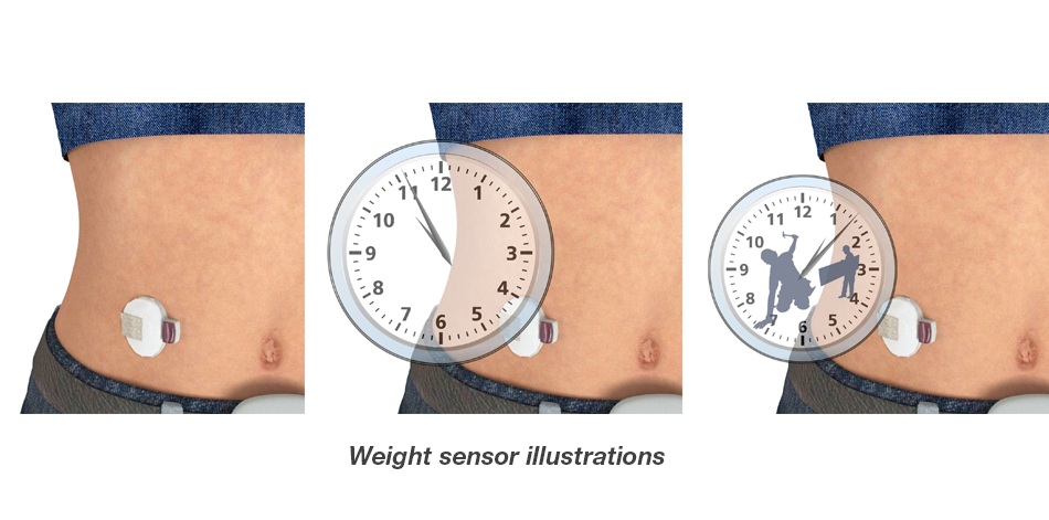 Weight sensor device infographic – 3D CAD and vector infographic ...
